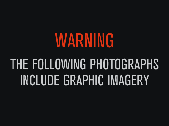 Another Malawian Woman Nude Photos Exposed Face Of Malawi